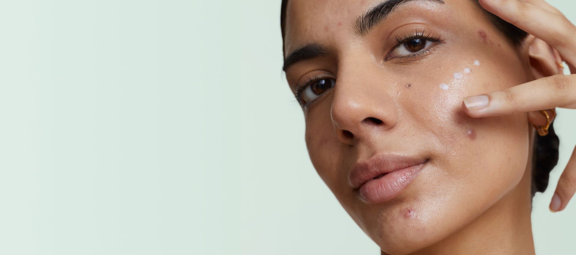 LaMuseLab - Acne and sensitive skin solutions